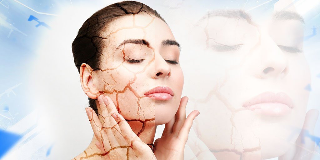 Dry skin: How to treat / Fix dry skin? - Blumen Biovitals
